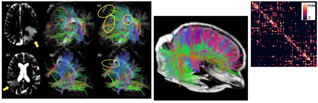 Diffusion Imaging | Chair of Imaging and Computer Vision – RWTH Aachen University
