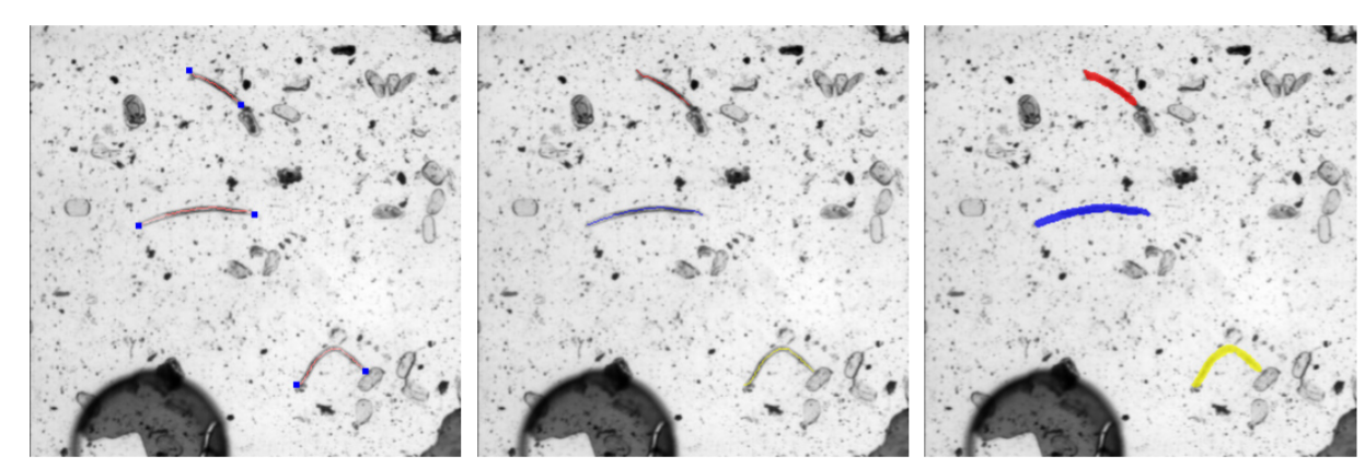 Nematodes | Chair of Imaging and Computer Vision – RWTH Aachen University